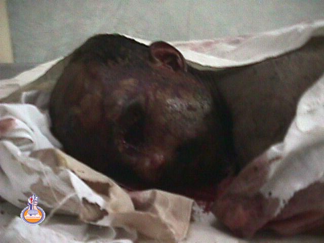 A powerful bomb blasted on 31st May 2004 at Masjid-o-Imambargah Ali ...